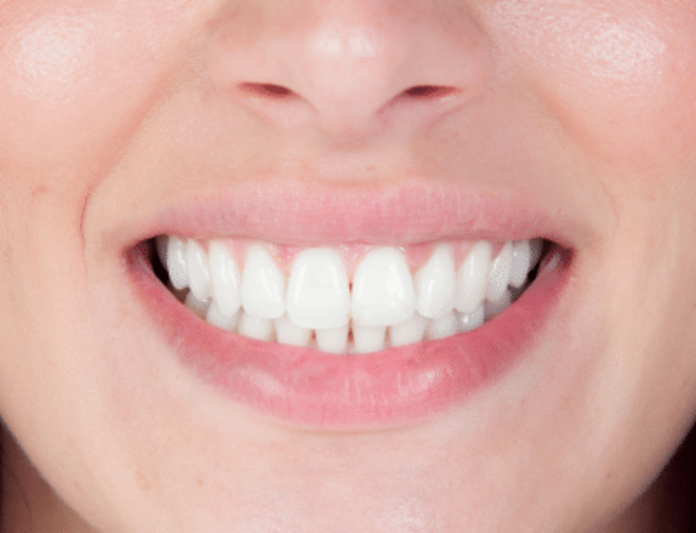 Summer Safety For Teeth | South Carolina